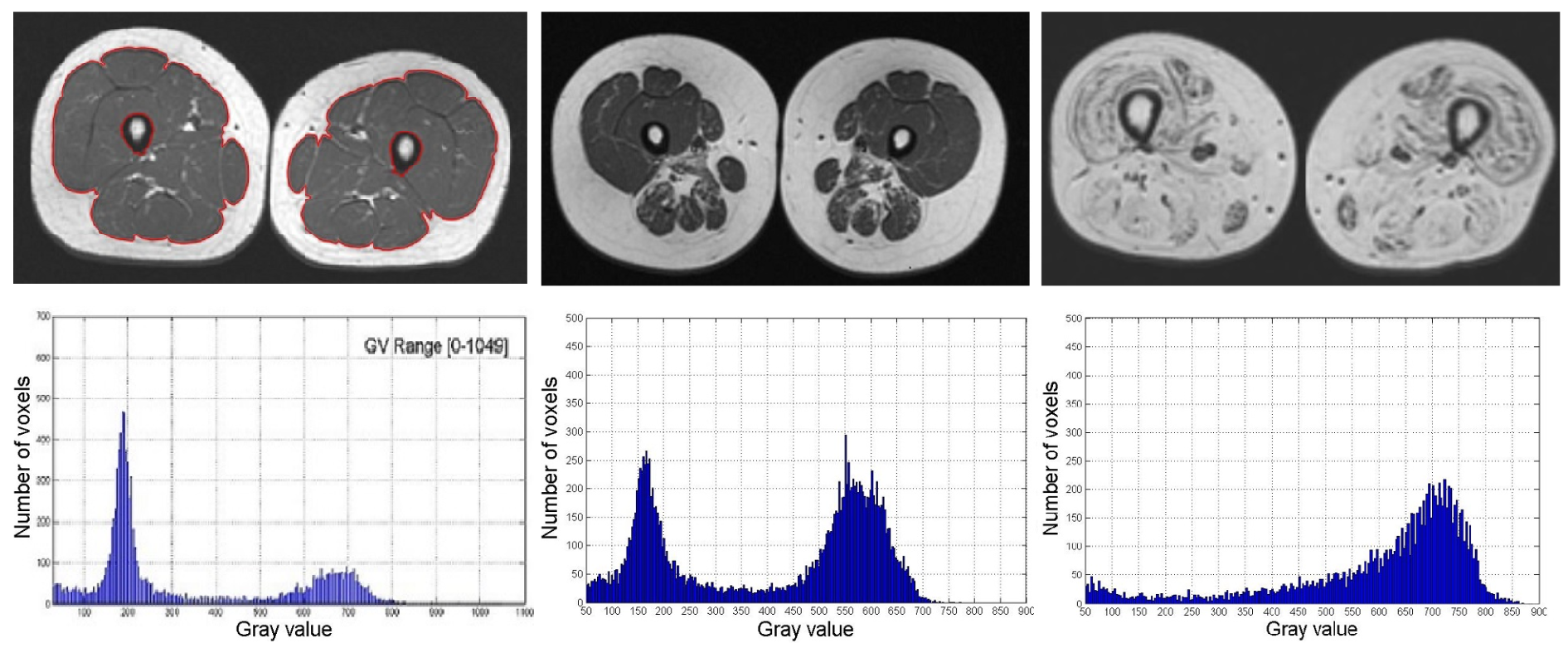 Medical Imaging and Instrumentation Group